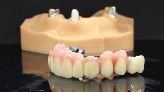 High Strength Titanium Crown And Bridge Coping With Composite