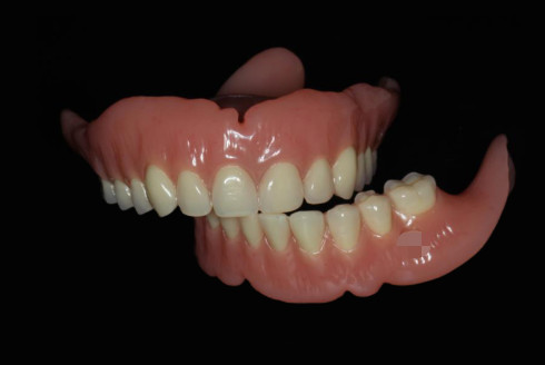 Printed Full Removable Dentures Digital Complete Denture Pink