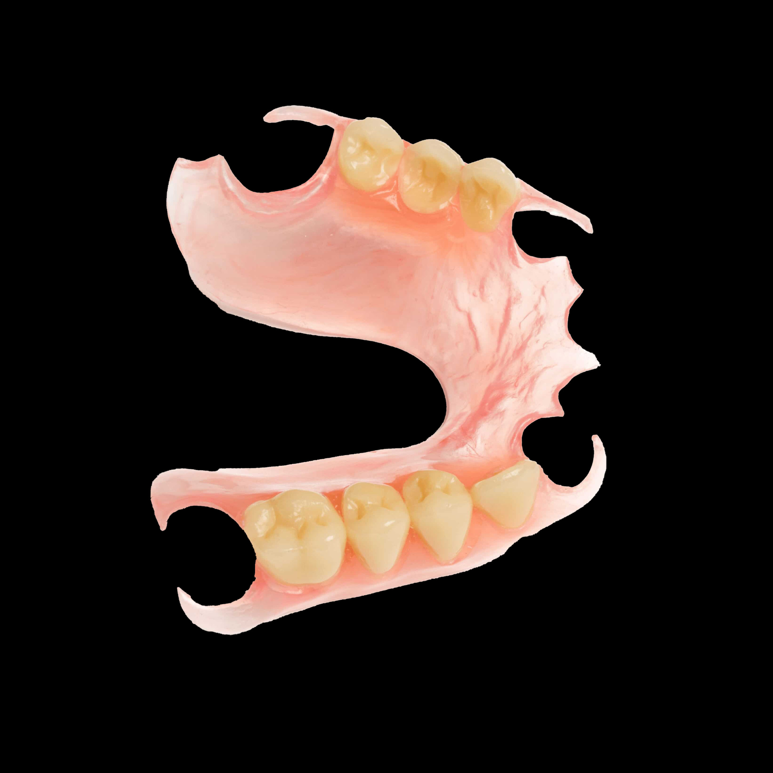 Pink TCS Flexible Partials Excellent Retention TCS Flexible Denture