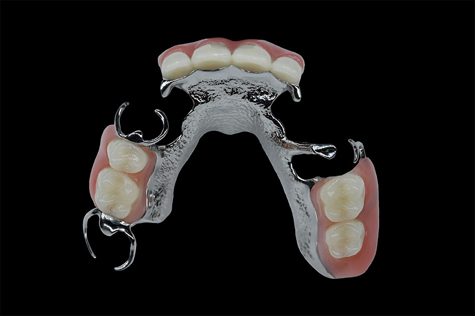 Customizable Removable Dentures Titanium Framework Dental Metal Framework